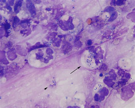 Rhodococcus Archives Eclinpath