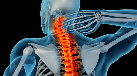 What Is A Spinal Stroke Northwestern Medicine