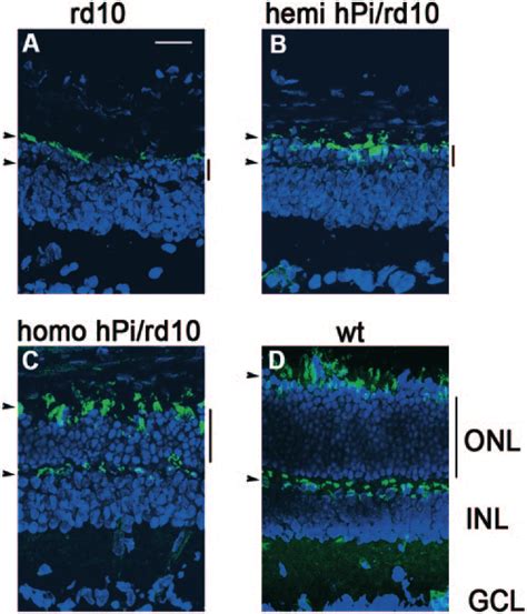 Preservation Of Retinal Structure In Hpi Rd10 Mice Retinal Sections Download Scientific