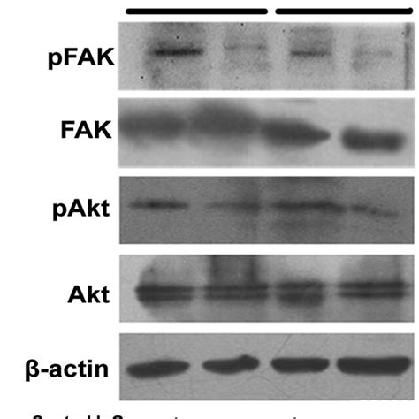 The Role Of B1 Integrin In Hepatocellular Carcinoma Multicellular Download Scientific Diagram