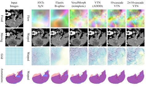 Iccv 2019 微软开源无监督学习的医学图像配准方法：递归级联网络 Csdn博客
