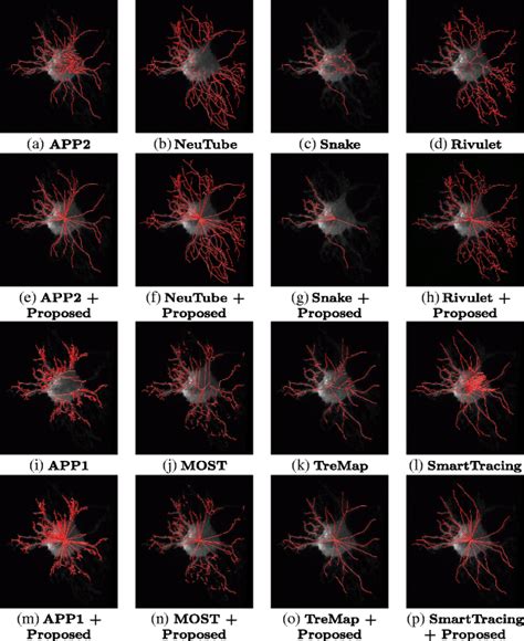 The Improvement Of Neuron Tracing Result By Considering Somatic