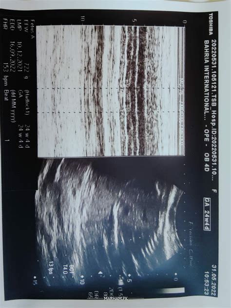 Ask A Gynecologist Online For Anomaly Scan Report Check Kindly