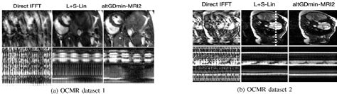 Figure 8 From Fast Low Rank Column Wise Compressive Sensing For Accelerated Dynamic Mri