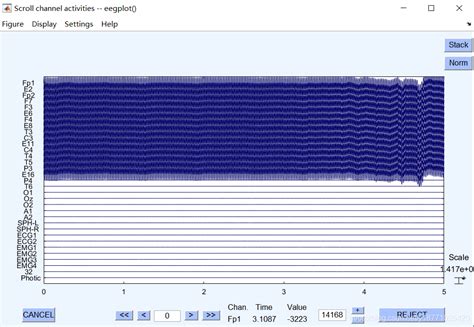 Matlab Edfeeglab安装、edf数据导入、eeg预处理（matlab） Csdn博客