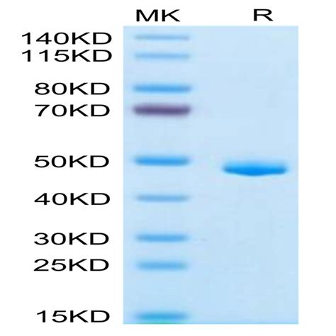 Human Clec7a Protein Cle Hm27a Kactus Biosystems Ushelf