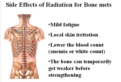 Bone Met Radiation Side Effects