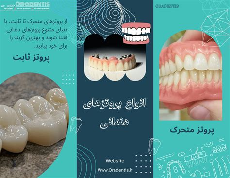 بایگانی‌های پروتزهای دندانی Oradentis