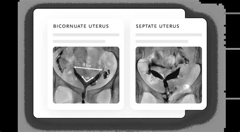 Clinical Decision Support For Radiology Statdx Elsevier