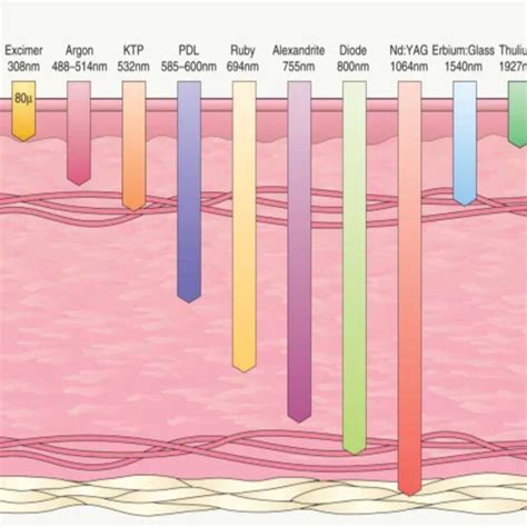 laser types and depth of penetration [30] download scientific diagram