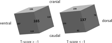 Schematic Representation Of Hounsfield Units In S1 In Patients With