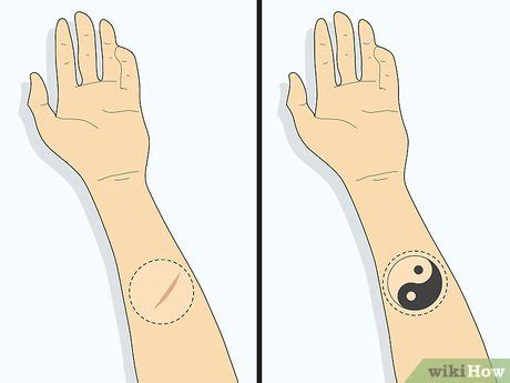 Simple Ways To Hide Scars On Your Arms WikiHow