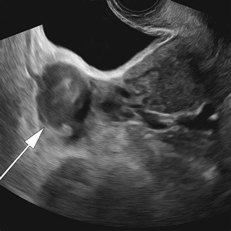 Axial And Coronal CT Images Of Three Different Patients With Different Download Scientific