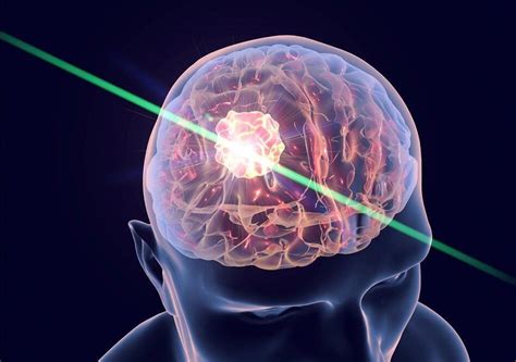 This Tiny “molecular Flashlight” Could Transform Brain Disease Detection Lifeboat News The Blog