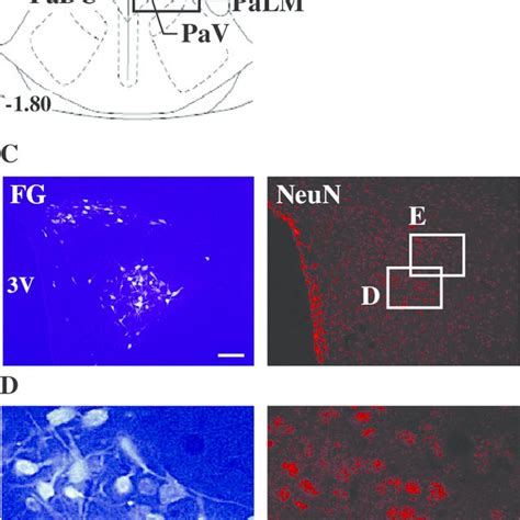 Distribution Of Spinally Projecting Neurons In The Paraventricular