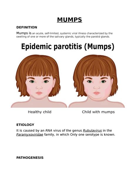 Mumps Mumps Definition Mumps Is An Acute Self Limited Systemic