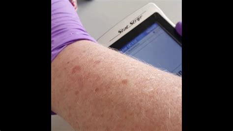 Performing Glucose Quality Control Qc On The Nova Statstrip Meter