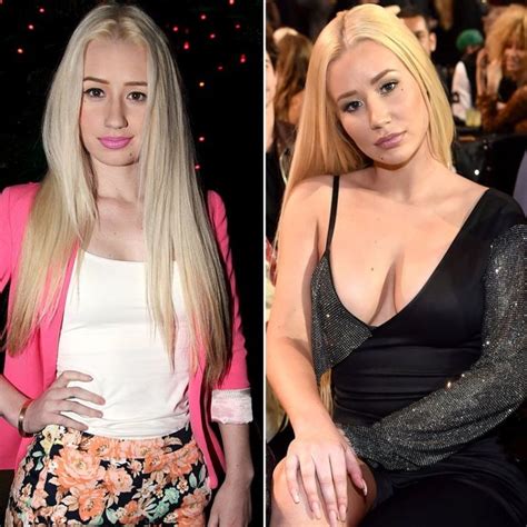 These Celebrities Admitted To Having Plastic Surgeries