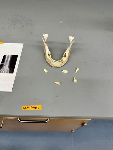 Joints Flashcards Quizlet