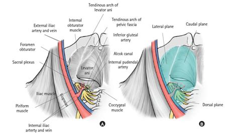 Essential Anatomy For Lateral Lymph Node Dissection Pmc
