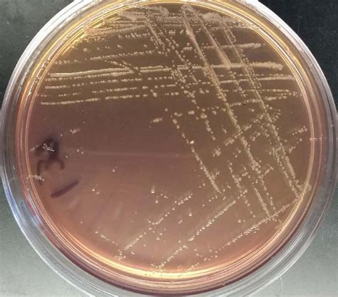 Quadrant Isolation Streak Of E Coli O2 Strain In Macconkey Agar After