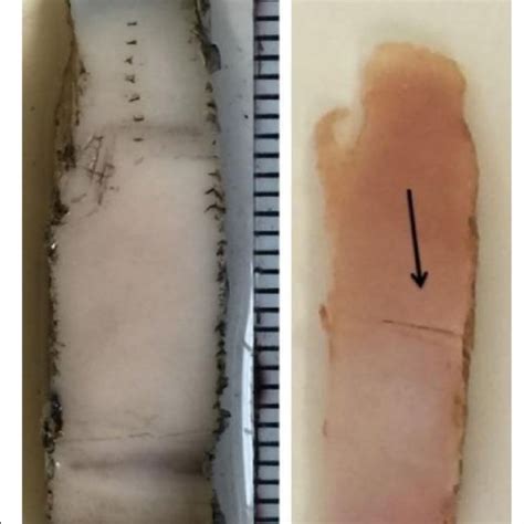 Cartilage Surface Crack Observed On Specimens That Reached Run Out At Download Scientific