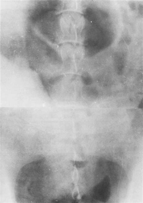 Left Ventradorsal Radiograph And Right Explanatory Diagram Of The Download Scientific