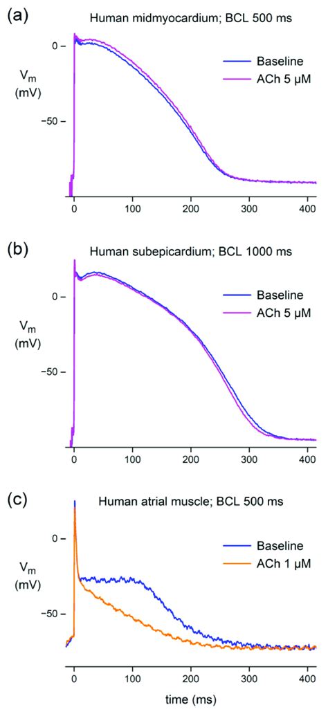 Ap Recordings Obtained With Microelectrode Impalements Of Human Download Scientific Diagram