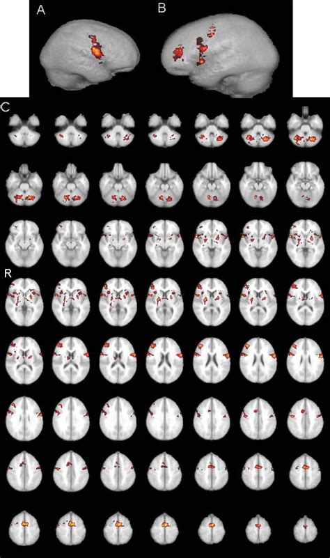 Fmri Whole Group Analysis Statistical Fmri Map Activation Patterns In Download Scientific