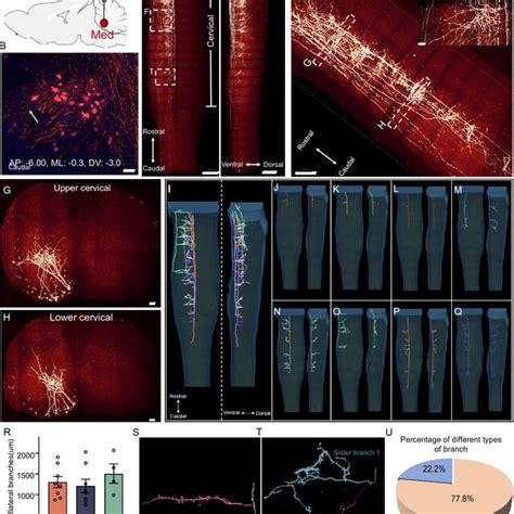 The Morphology Of Superior Colliculus Neuron Axons In The Mouse Spinal Download Scientific