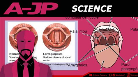 Lets Make A Laryngospasm Algorithm Medicine Youtube