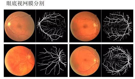10分钟看懂全卷积神经网络（ Fcn ）：语义分割深度模型先驱禅师
