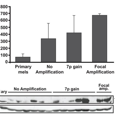 ETV1 Expression In Relation To Chromosome 7p Copy Gains A Normalized Download Scientific