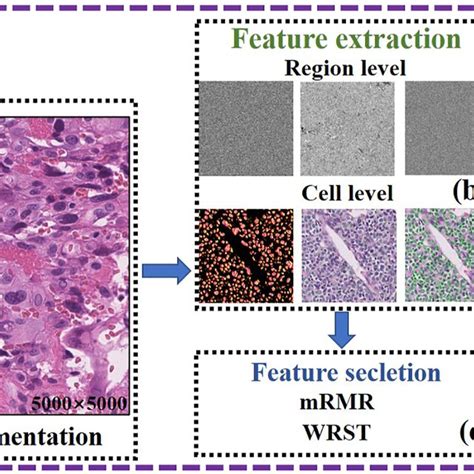 The Illustration Of The Oshic Construction Rois Selection Phase A
