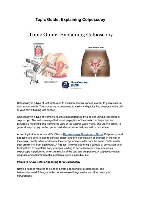 Ppt Topic Guide Explaining Colposcopy Powerpoint Presentation Free Download Id11098601