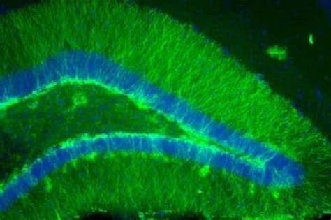 New Clues About The Development Of Epilepsy Neuroscience News