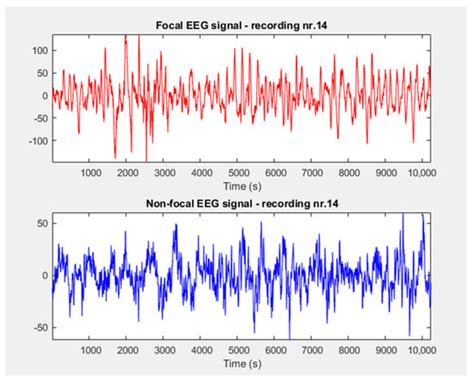 A Novel Automated Empirical Mode Decomposition Emd Based Method And