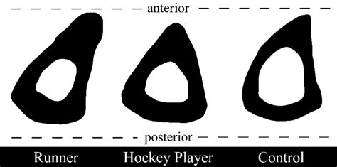 Example Tibia Midshaft Cross Sections For Runners Hockey Players Download Scientific