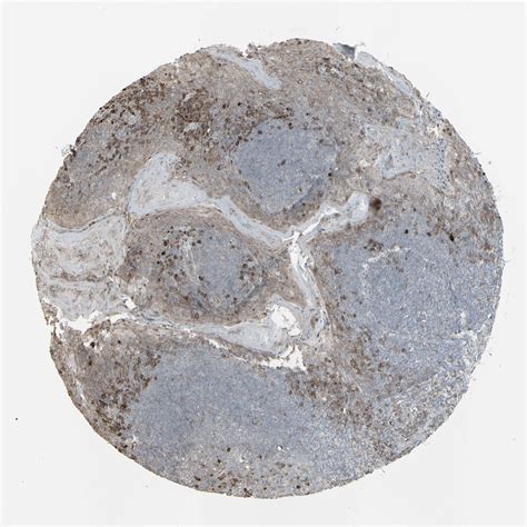 Tissue Expression Of Cd33 Staining In Tonsil The Human Protein Atlas