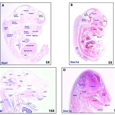 Nipbl And Smc1a Expression Is Modulated During Development In Situ