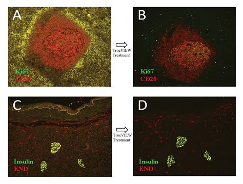 Reducing Tissue Autofluorescence