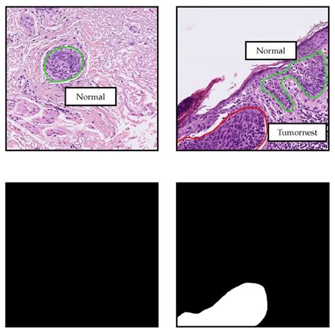Unet Architecture With A Resnet 34 Encoder The Output Of The