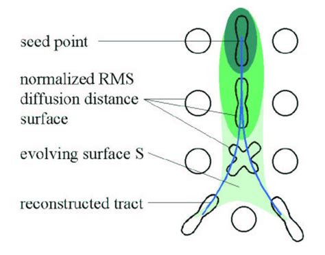 Schematic Of Tracking Algorithm 2d Projection Of Surface Evolution And