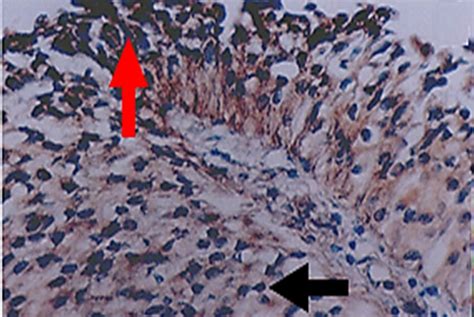 Positive Red Pointer And Negative Black Pointer Cytoplasmic