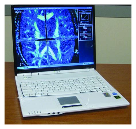 Stereoscopic Visualization Of Diffusion Tensor Imaging Data A Comparative Survey Of