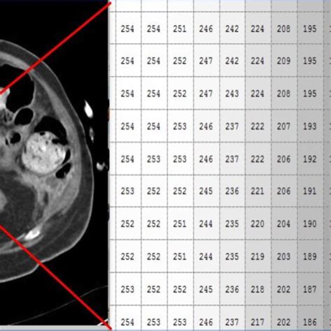 CT Image Visualized With MATLAB Download Scientific Diagram