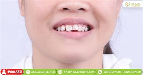 M T L Ch B N To B N Nh Ph I L M Sao C Ch Kh C Ph C