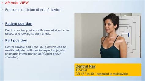 X Ray Views Of Shoulder Joint And Related Structures Pptx