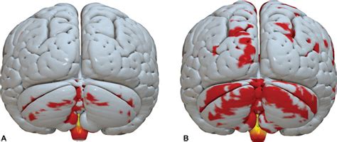 Illustration Of Structural Connectivity Topographies With Higher