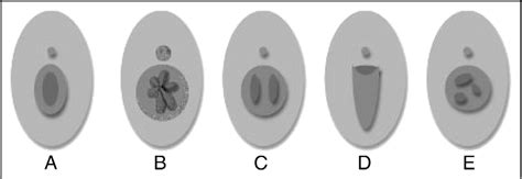 Cribriform Hymen